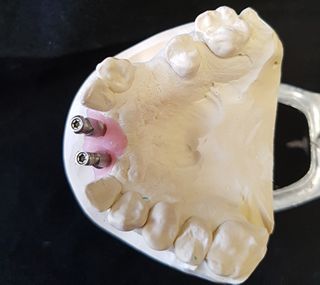 Variobase for crown angled solutions